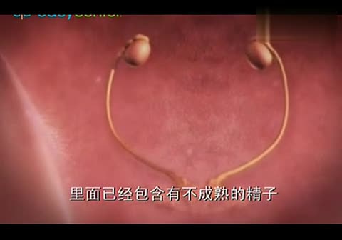 胎儿发育过程-胎儿男孩女孩的形成(视频) 视频