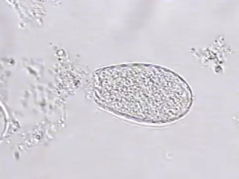 显微镜下的细菌