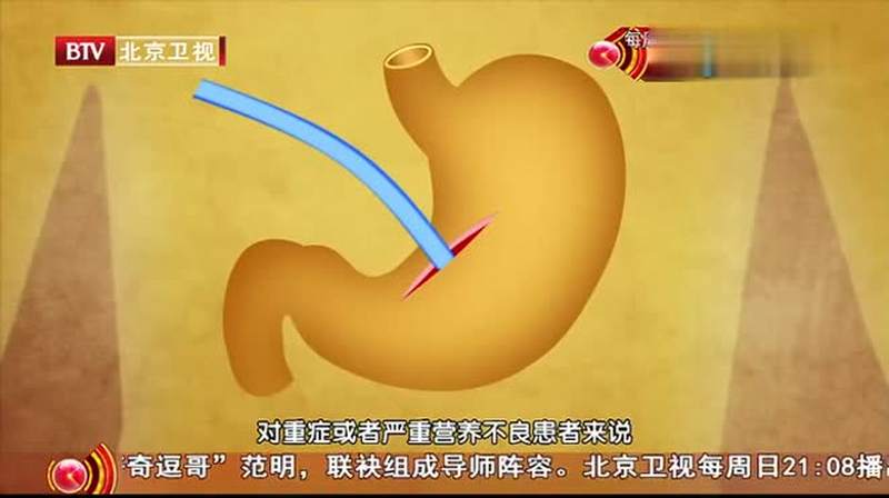 当吞咽困难的时候 医生的治疗办法