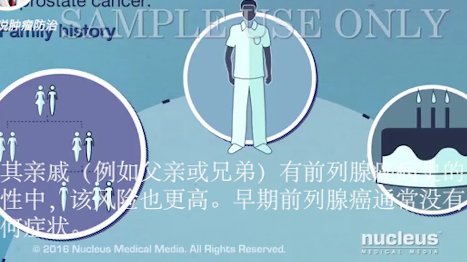 了解前列腺癌,大多数前列腺癌的生长速度比其他类型的癌症慢
