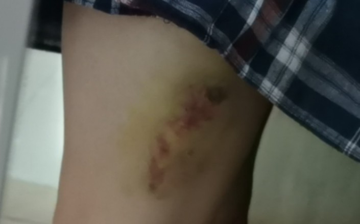 第一次骑共享电动车,人还没上车就飞出去了