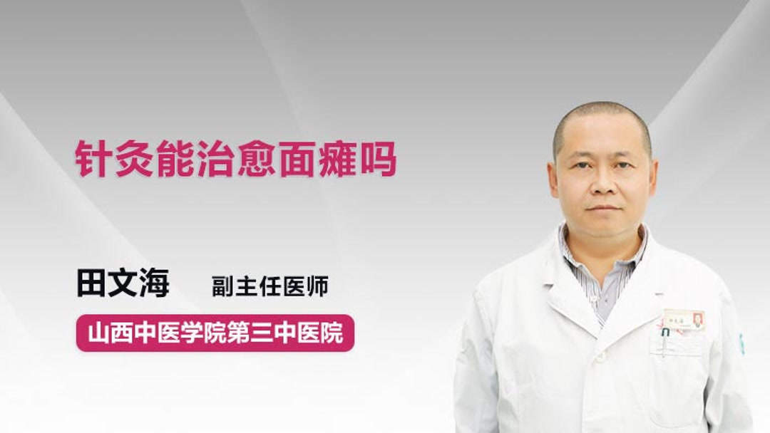 针灸能治愈面瘫吗