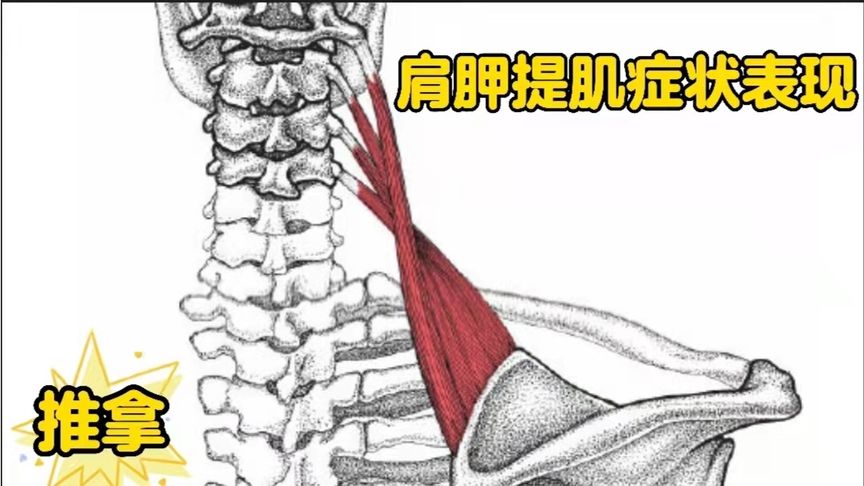 颈椎此处痛,并非颈椎病。曹修行原发点疗法推拿指导。