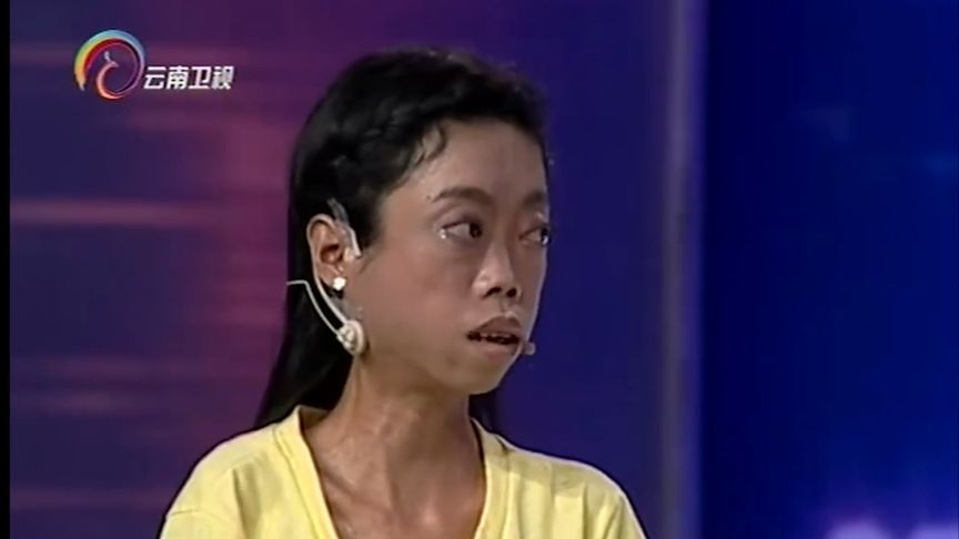 残疾女孩励志故事,全身肌肉萎缩瘦如竹竿,现场献唱众人感动落泪