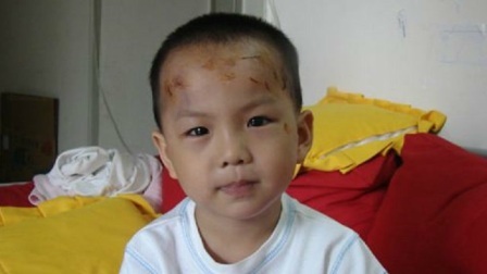 幼儿园宝宝三番四次受伤,老师不动于衷,妈妈一句话震住所有人!