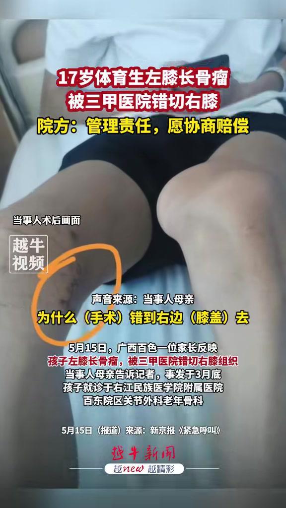 ...被三甲医院错切右膝,院方:管理责任,愿协商赔偿#离谱#医疗事故#关注