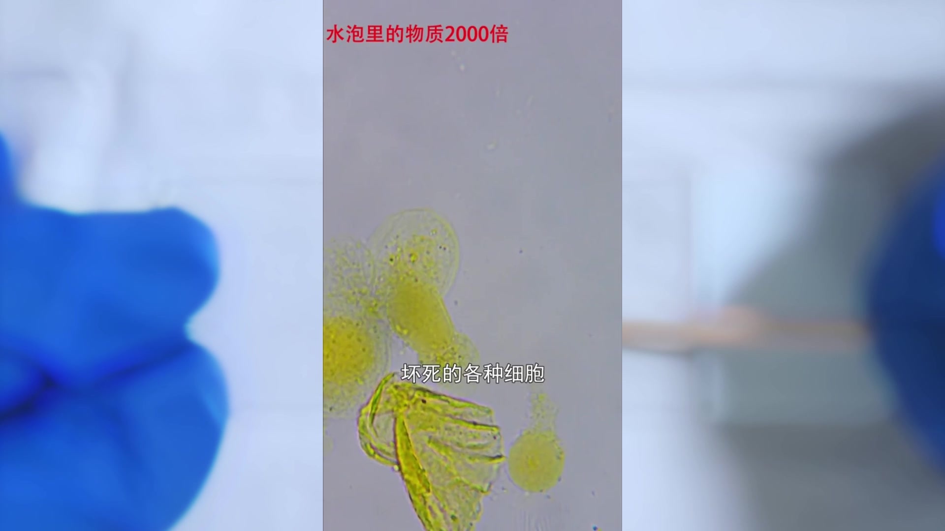 手上到底有多少细菌?显微镜下放大1500倍观察(第一集)