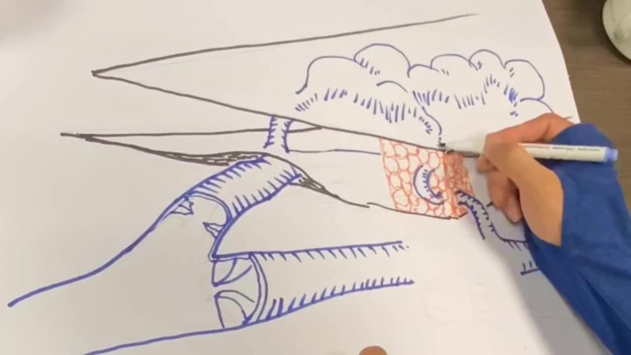 【外科医生都会画画】非常感谢小时候母亲送我去学画画,几十年以后...