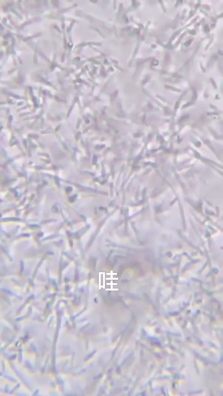 手上到底有多少细菌呢我们显微镜看一下