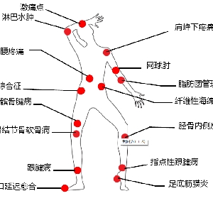 冲击波治疗师竹子 