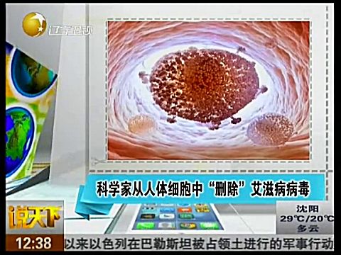 科学家从人体细胞中“删除”艾滋病病毒[说天下]