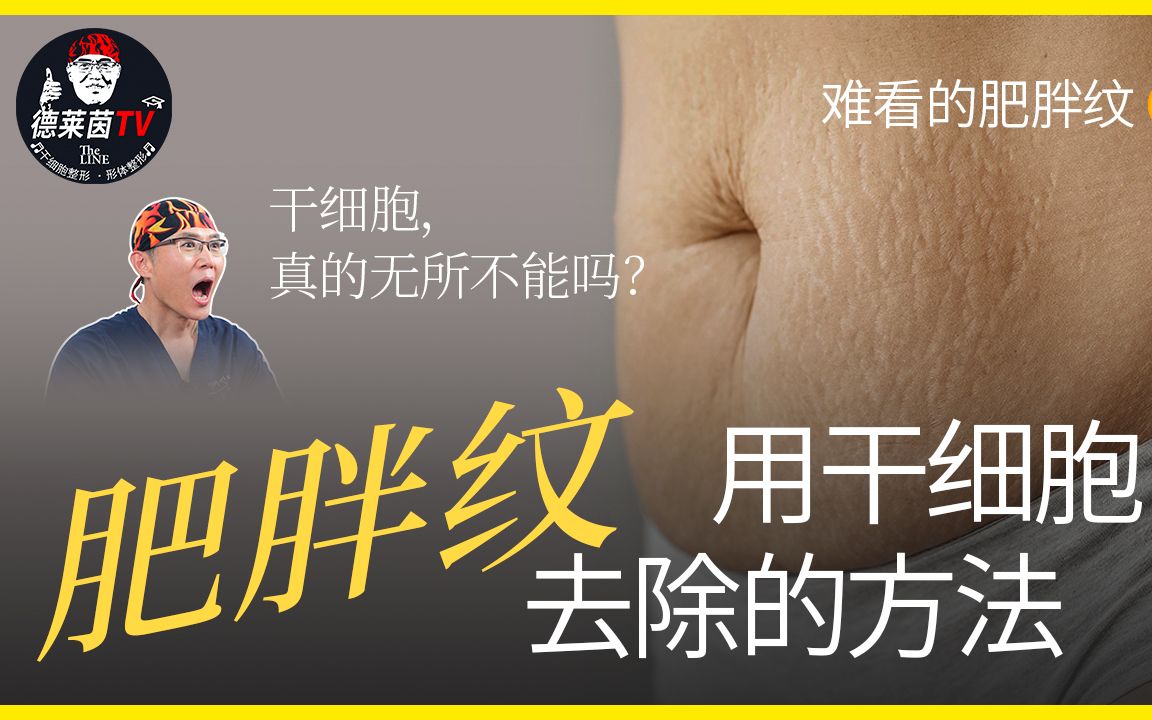 【韩国德莱茵】这可能是最有效的肥胖纹去除法!用干细胞去除肥胖纹...