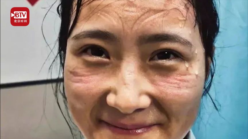 抗疫医护满是勒痕的笑脸 战胜“新冠”的勇气与希望