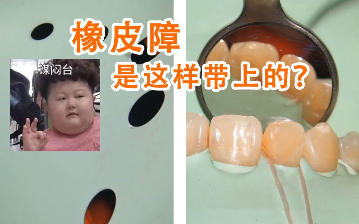 带橡皮障还得这样操作
