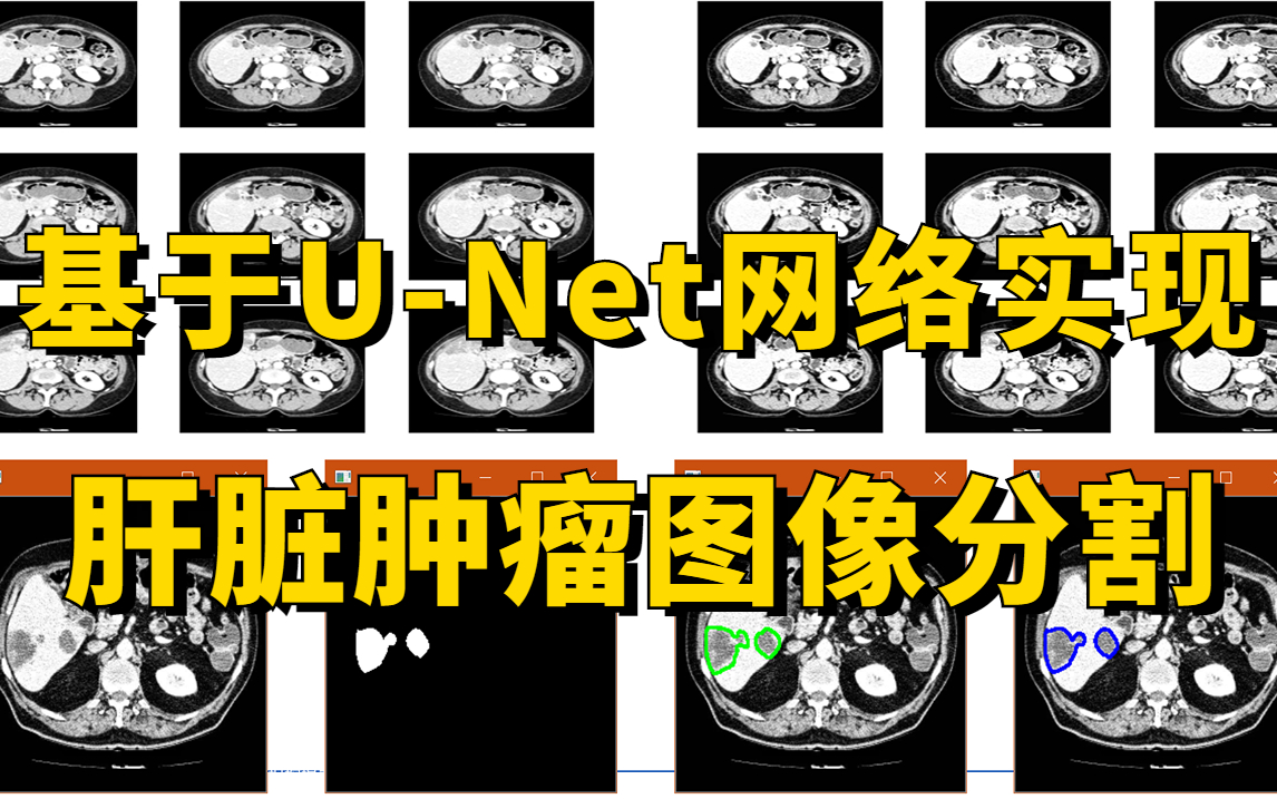 ...医学人工智能项目实战:基于U-Net网络实现肝脏肿瘤图像分割,从环境...