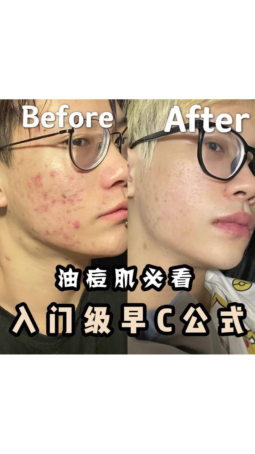 入门级早c公式来了,焕肤修复住