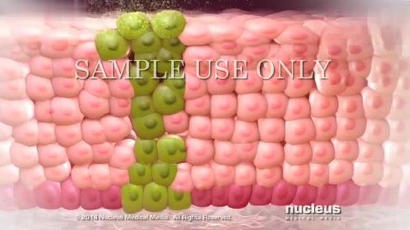 医学3D动画:认识人类乳头瘤病毒HPV及其危害