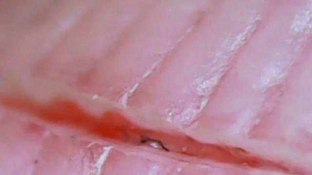 原来人受伤的伤口是这样自动愈合!看了动画模拟,网友:奇妙的生命