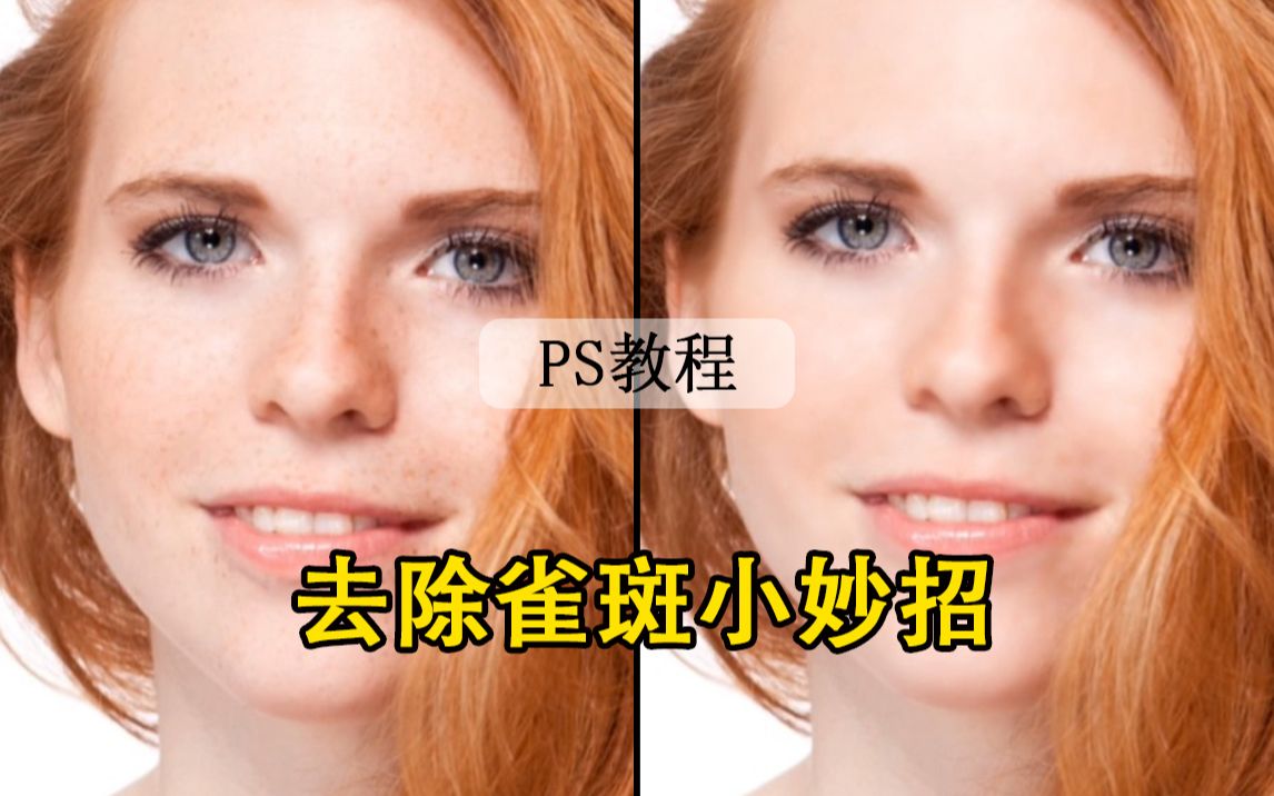 【PS教程】PS教你如何祛除雀斑小妙招