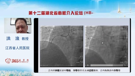 洪浪:逆向微导管无法沟通时的处理技术【第十二届湖北省心脏介入...