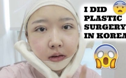 【整形实录】韩国美女整容经历第二期-双眼皮和瘦脸手术@油兔不二...