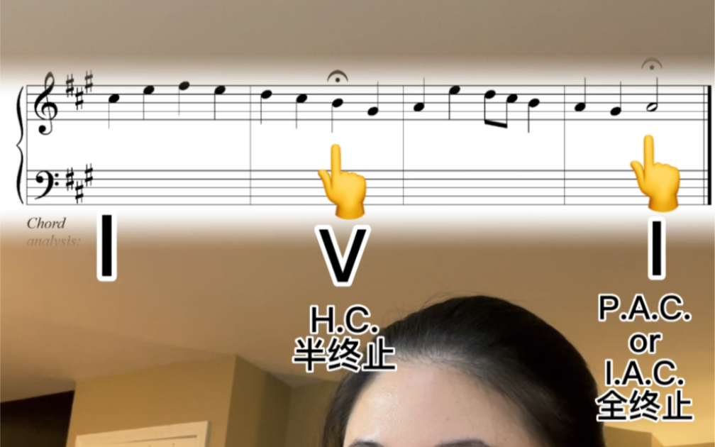 ...| AP乐理真题讲解:为旋律声部写低音!如何安排Cadence(终止式)?