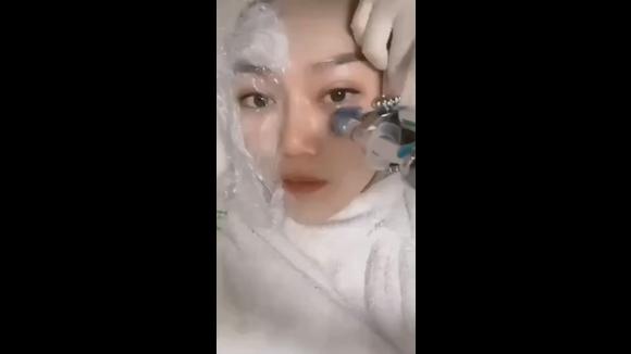 干细胞生长疗法