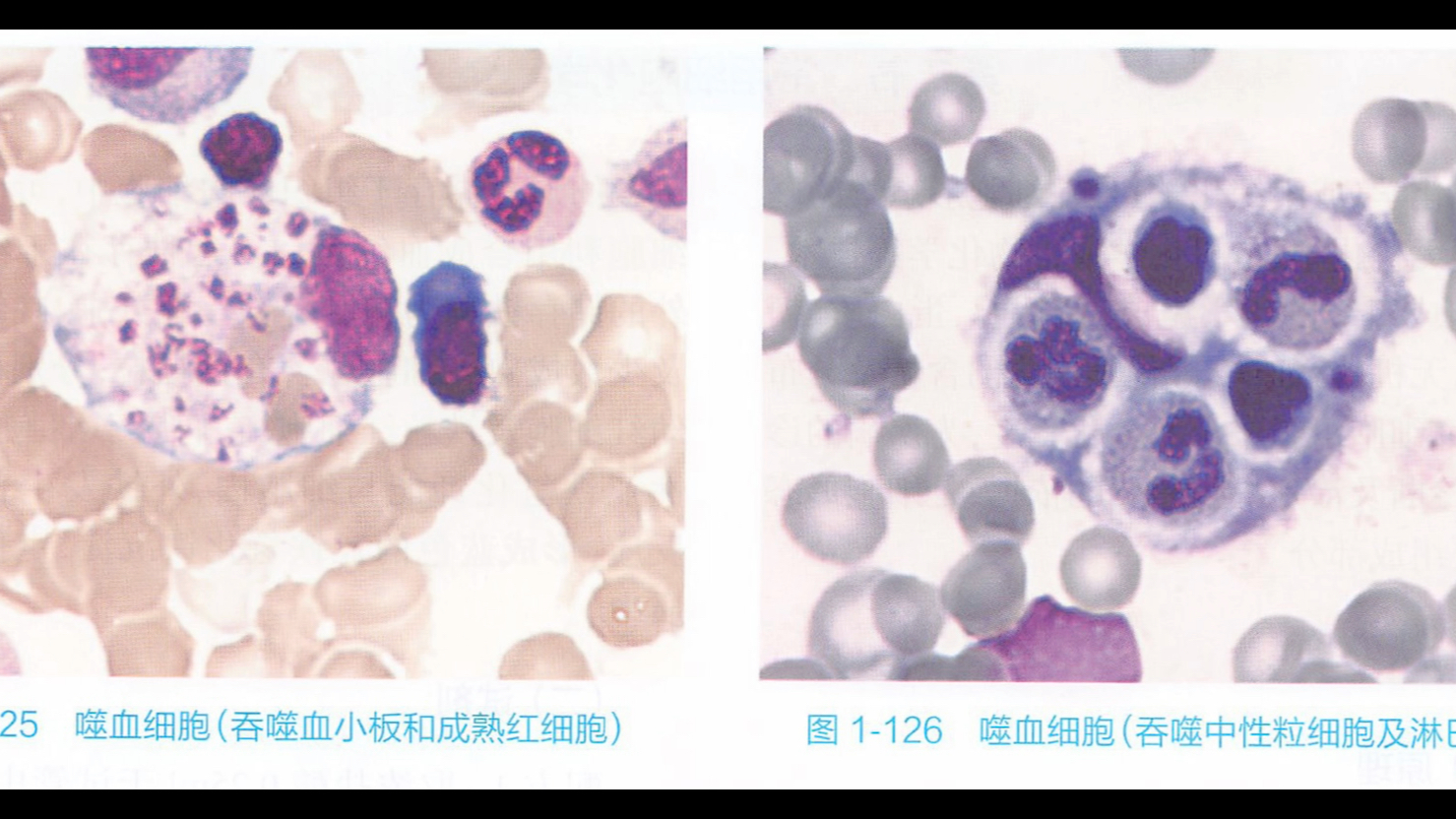 临床血液学检验—骨髓细胞—造血组织非造血细胞