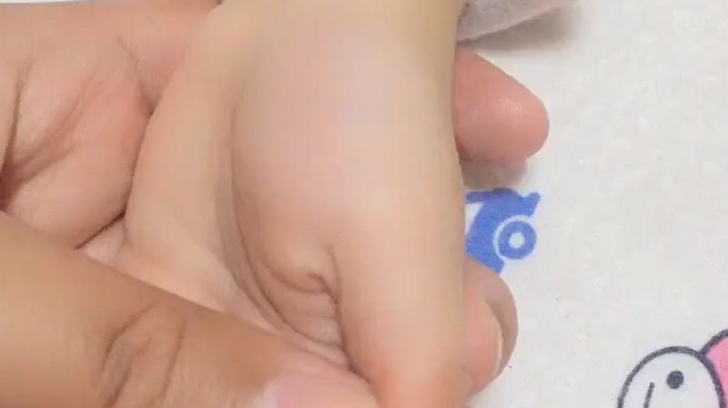 小儿推拿是有一定道理和作用的