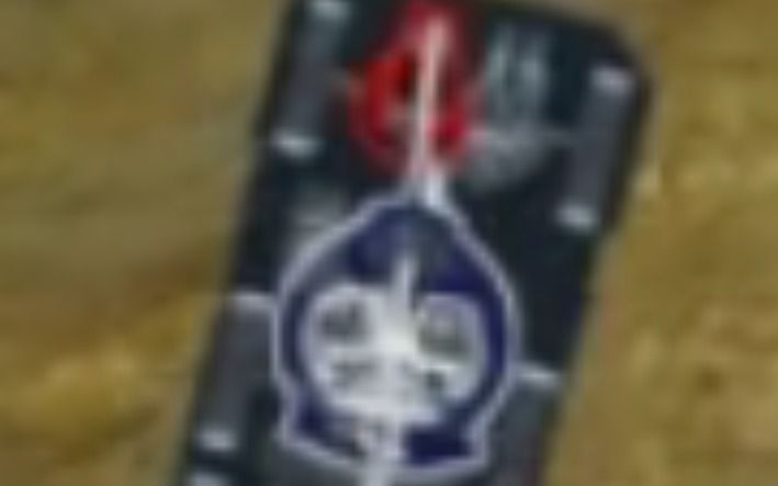 惨烈!汽车驾驶员未系安全带,因路面颠簸导致头部受到撞击造成颅脑...