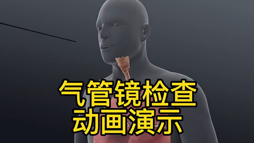 气管镜检查过程高清动画演示,建议收藏!