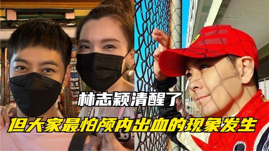 林志颖已经清醒了!但医生和媒体最担心有颅内出血的现象发生