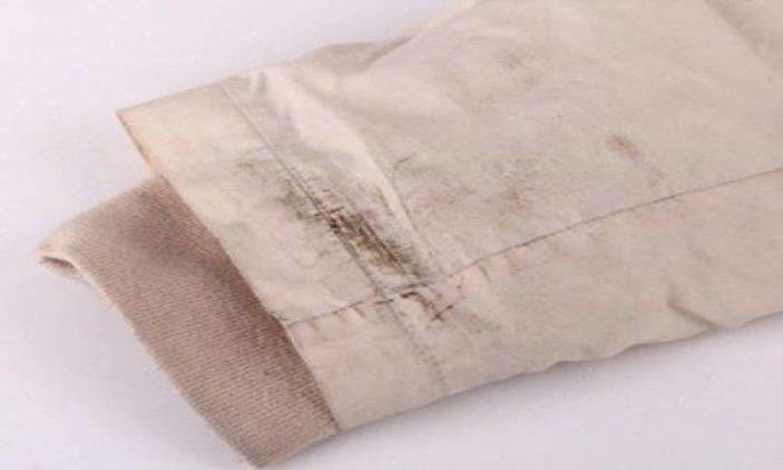 羽绒服袖口脏了可别花钱洗,教你一招快速洗净不费事,方法太棒了