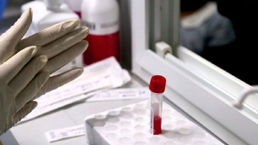 启用“追阳”核酸采样点!青岛一地最新发布