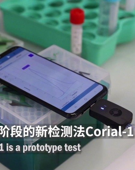 【法国新型新冠检测法10分钟内出结果 可与智能手机配合】近日,法国...