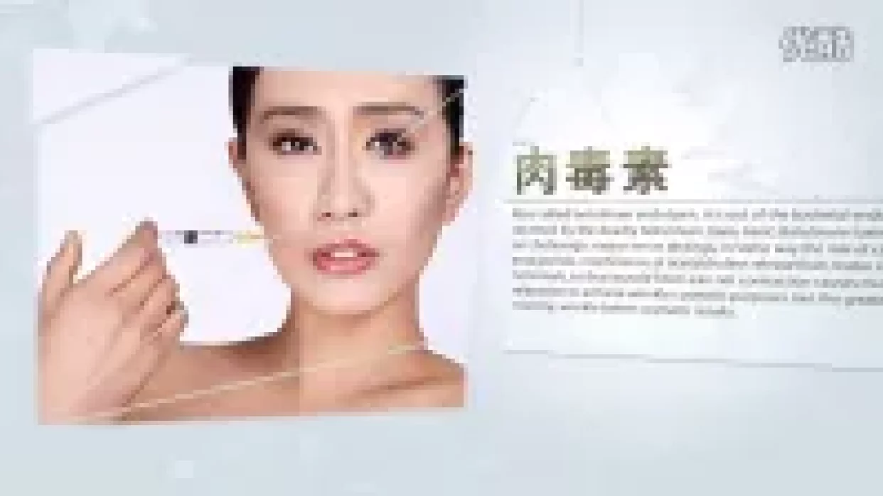 最新非法注射美容课程案例肉毒素面颊提升