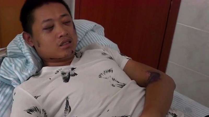 男子骑摩托车醉驾撞人,翻墙逃逸时摔断腿,网友:这就叫自作孽!