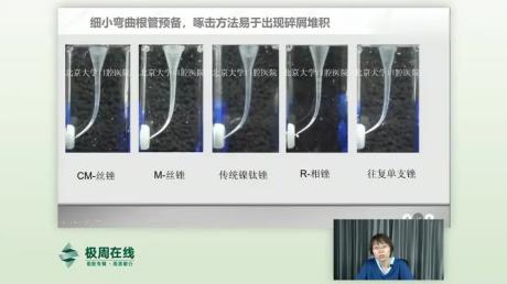 15分钟快速了解弯曲根管的预备方法