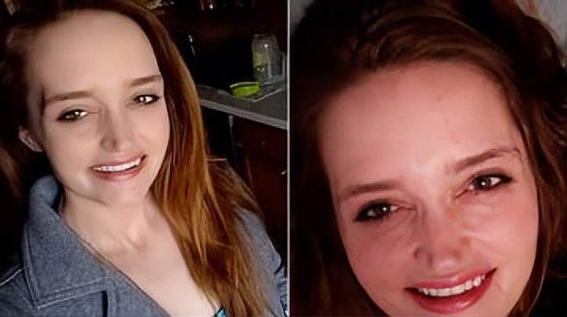 意外！美国37岁女子散步时被7条狗咬死，警方：当时太恐怖