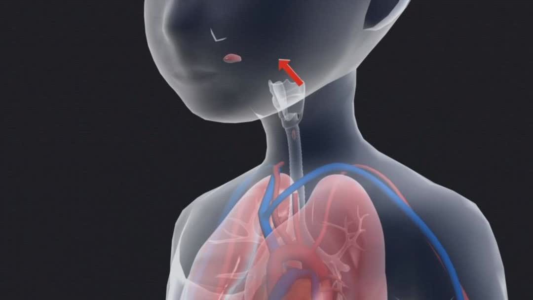 心脏瓣膜病的症状是什么?有这几点表现?