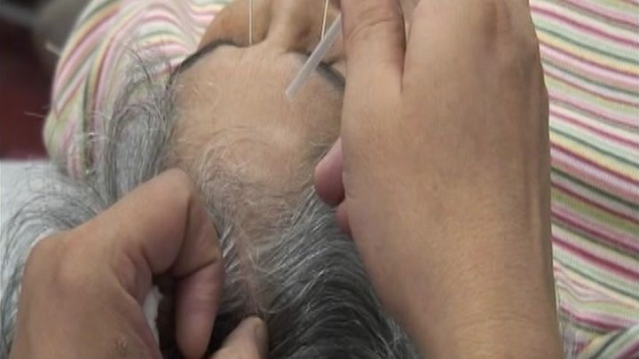 倪海厦老师 中医针灸临床7 眼科针法 养老穴 臂臑穴 光明穴