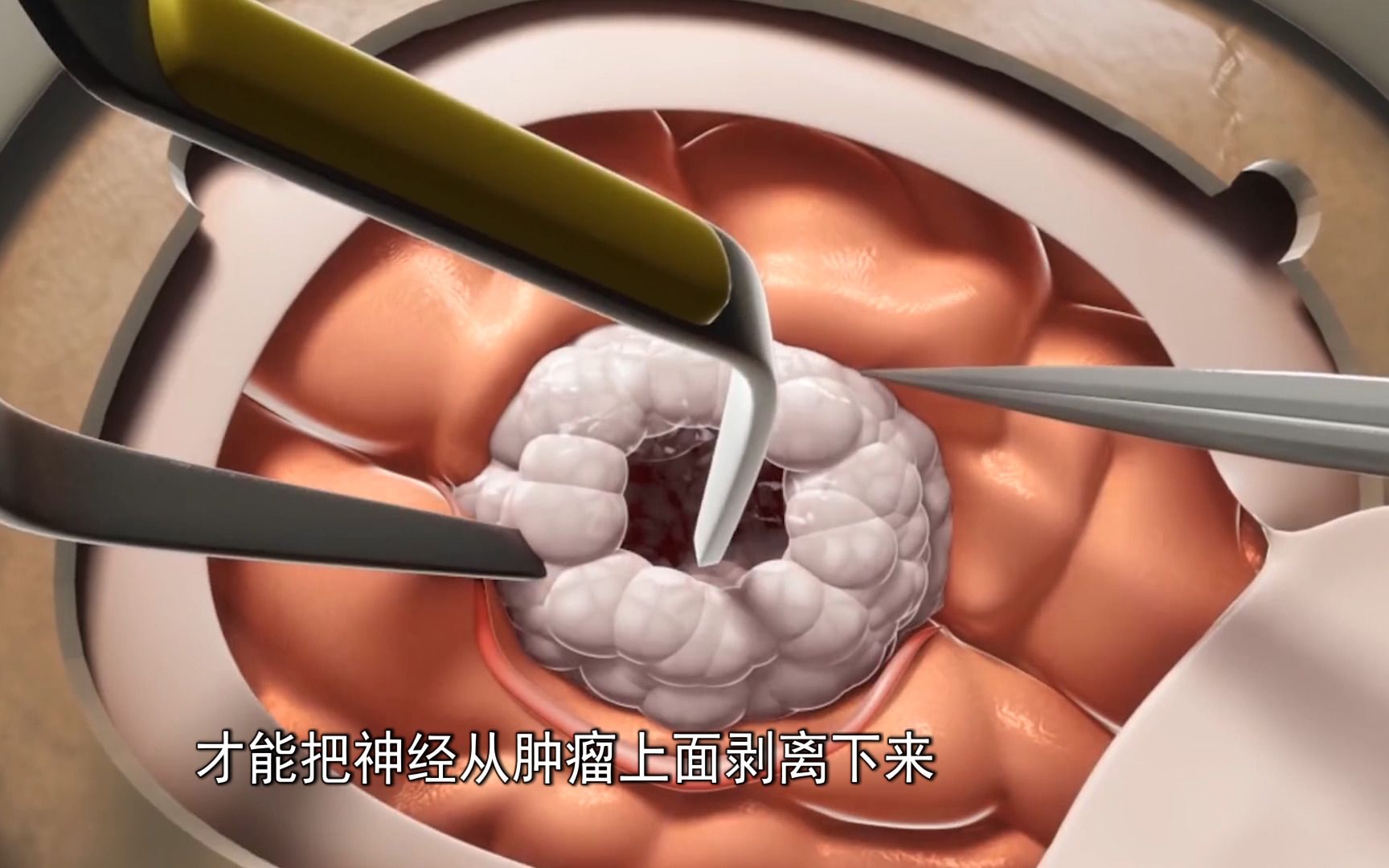 万物皆可缝——神经外科医生是如何练手的?