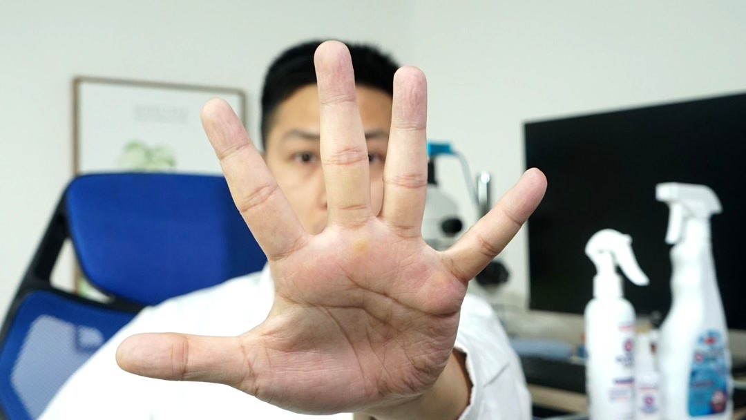 手上到底有多少细菌?放大1500倍看,你还敢不洗手吗