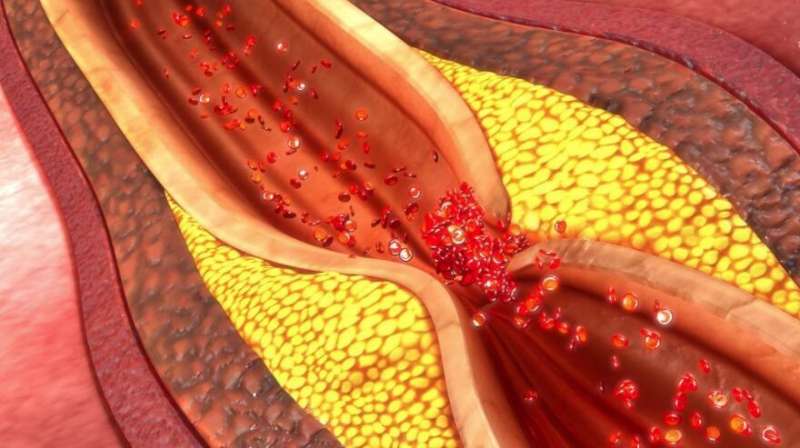 身体一旦出现这4个特征,多半血管已堵塞,请尽早去医院检查