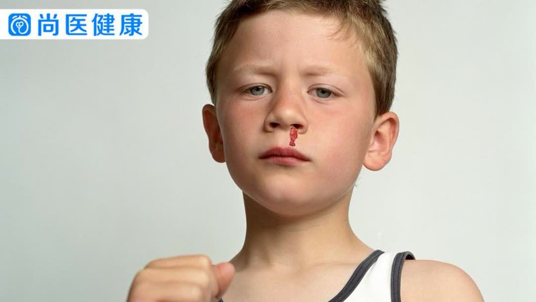 春天鼻子干燥流鼻血怎么办?专家教你一个止血小妙招!