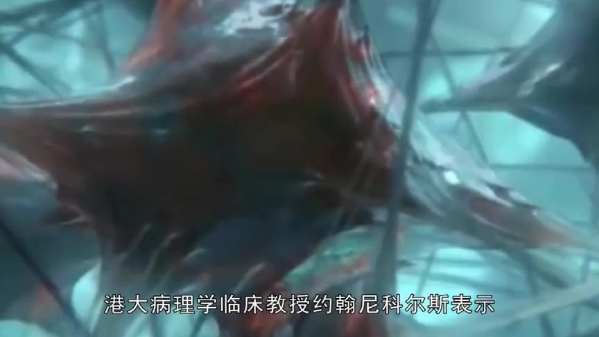 新冠病毒波及全球20多个国家,那么它的真面目到底长啥样?