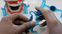君晓天云牙齿美白开口器 m型开口器 扩口器 撑口器 张口器 带镜开口器...