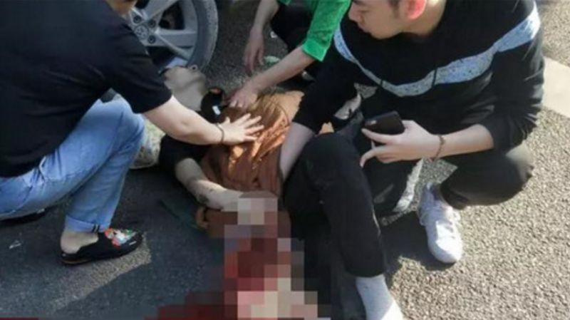 浙江温州发生重大交通事故,别克轿车撞倒行人,送医后遭截肢