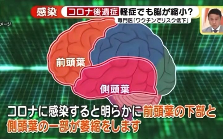 奥密克戎轻症亦会损伤大脑