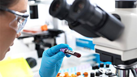 这种血型比熊猫血罕见,在一名孕妇身上发现,全球仅1人拥有!